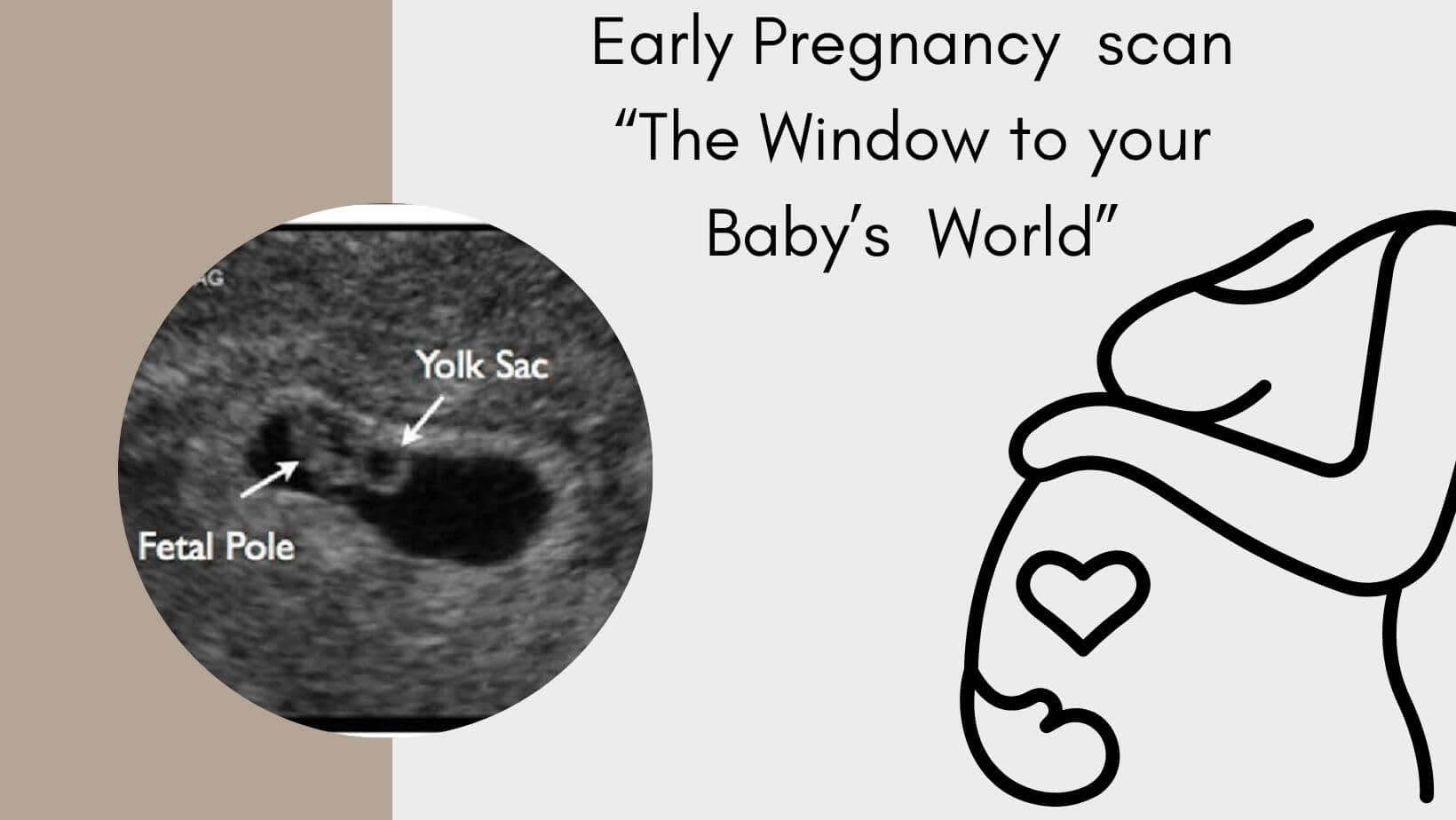 The Importance Of Early Pregnancy Scans Ensuring A Healthy Journey